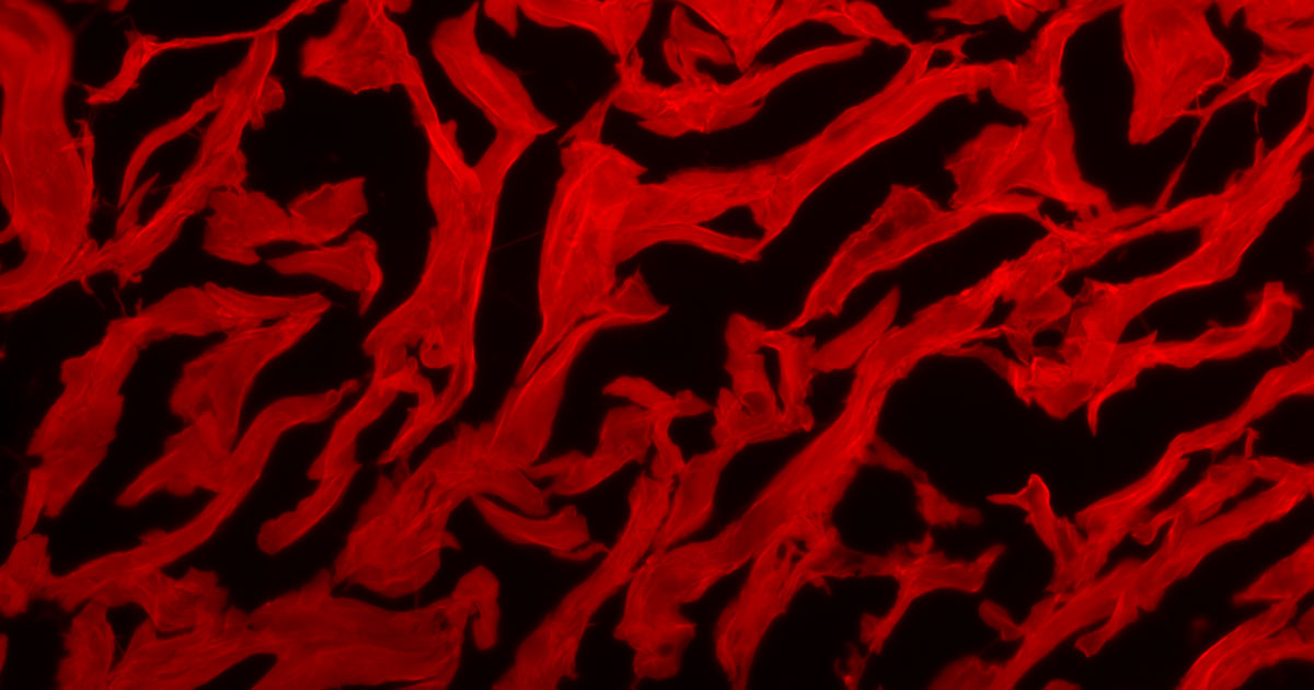 Biomedical engineer takes top prize in Art of Science contest ...